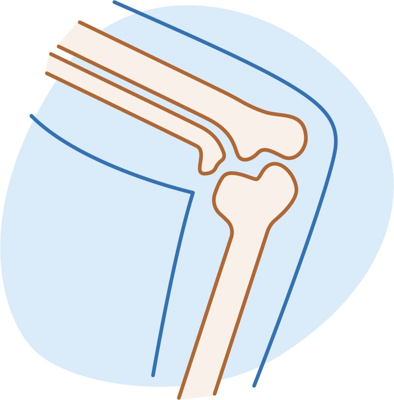 Menopause Symptoms | Joint Pain | My Menopause Centre Menopause Symptoms | Joint Pain | My Menopause Centre
